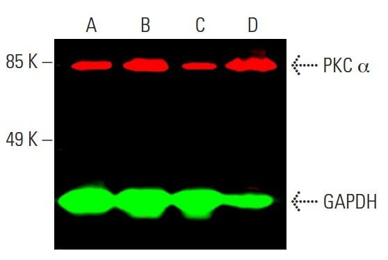 PKC alpha抗体 (H-7) | SCBT - Santa Cruz Biotechnology