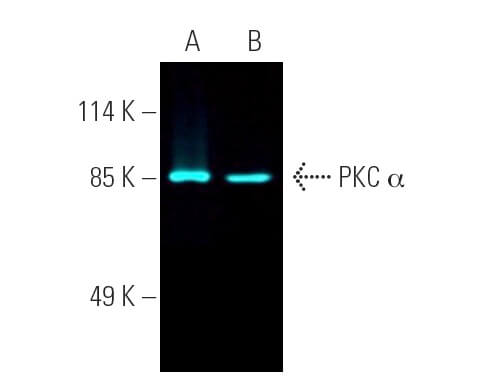 PKC α Antibody (H-7) | SCBT - Santa Cruz Biotechnology