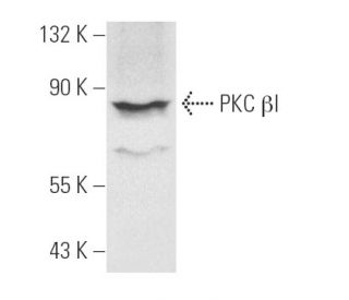 PKC βI Antibody (E-3) - Western Blotting - Image 1999