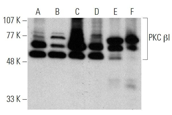 PKC beta 1 Antibody (E-3) | SCBT - Santa Cruz Biotechnology