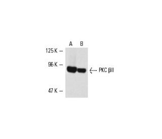 PKC βII Antibody (C-18) | SCBT - Santa Cruz Biotechnology