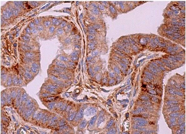 PKC lambda/iota Antibody (E-7) | SCBT - Santa Cruz Biotechnology