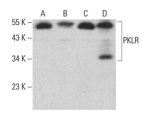PKLR抗体 (E-2) | SCBT - Santa Cruz Biotechnology