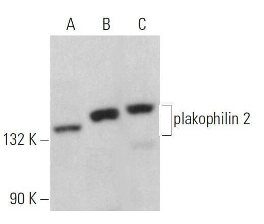 plakophilin 2 Antibody (C-1) | SCBT - Santa Cruz Biotechnology