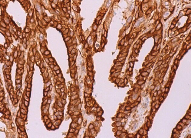 Plastin Antibody (F-2) | SCBT - Santa Cruz Biotechnology