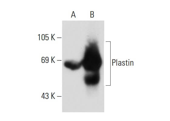 Plastin Antibody (F-2) | SCBT - Santa Cruz Biotechnology