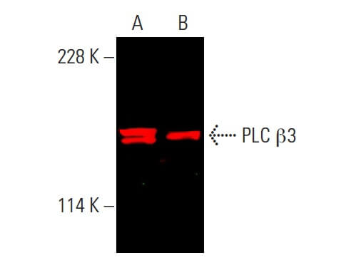 PLC β3 Antibody (D-7) | SCBT - Santa Cruz Biotechnology