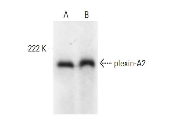 plexin-A2抗体 (A-2) | SCBT - Santa Cruz Biotechnology