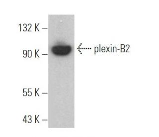 Anti-plexin-B2 Antibody (A-5) | SCBT - Santa Cruz Biotechnology
