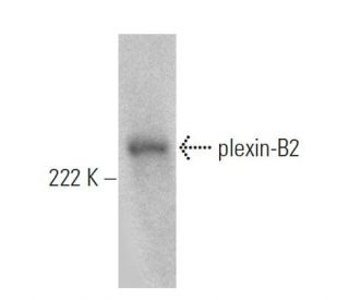 Anti-plexin-B2 Antibody (H-12) | SCBT - Santa Cruz Biotechnology