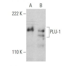 PLU-1 Antibody (7H3D7) - Western Blotting - Image 368286