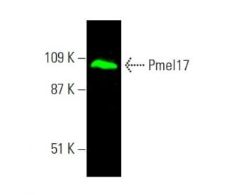 Anti-Pmel17 Antibody (E-7) | SCBT - Santa Cruz Biotechnology