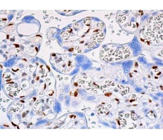 PML Antibody (PG-M3) - Immunohistochemistry - Image 353900