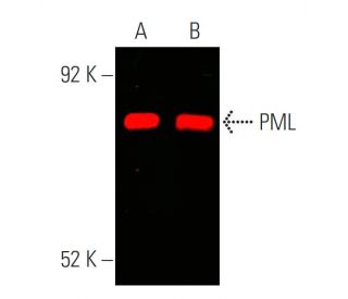 PML Antibody (PG-M3) - Western Blotting - Image 398443