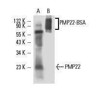 PMP22 Antibody (PMP22H1) | SCBT - Santa Cruz Biotechnology