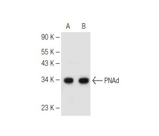 Anti-PNAd Antibody (E-11) | SCBT - Santa Cruz Biotechnology