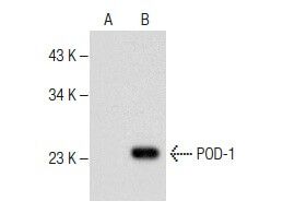POD-1 Antibody (A-6) | SCBT - Santa Cruz Biotechnology