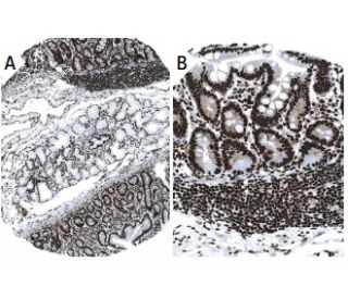 Anti-Pol II Antibody (CTD4H8) | SCBT - Santa Cruz Biotechnology