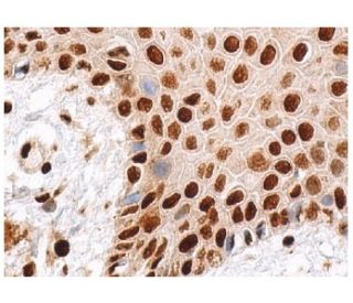 Pol II Antibody (CTD4H8) | SCBT - Santa Cruz Biotechnology