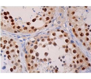 Anti-Pol II Antibody (CTD4H8) | SCBT - Santa Cruz Biotechnology