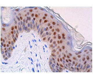 Anti-Pol II Antibody (CTD4H8) | SCBT - Santa Cruz Biotechnology