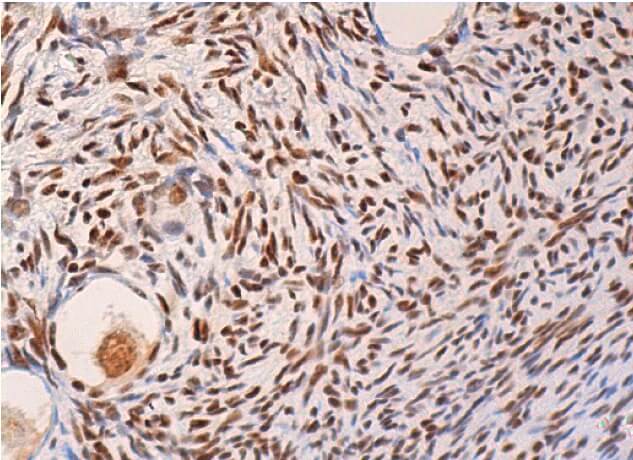 Anti-Pol II Antibody (CTD4H8) | SCBT - Santa Cruz Biotechnology