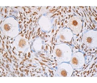 Anti-Pol II Antibody (CTD4H8) | SCBT - Santa Cruz Biotechnology
