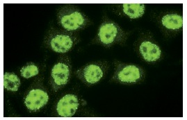 Anti-Pol II Antibody (F-12) | SCBT - Santa Cruz Biotechnology