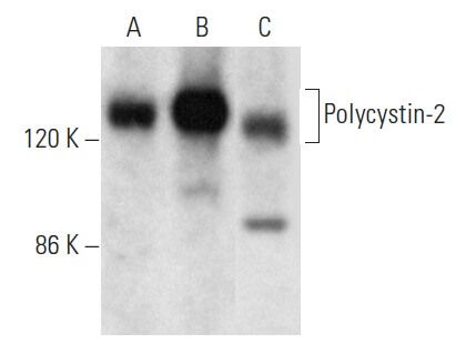 Polycystin-2抗体 (D-3) | SCBT - Santa Cruz Biotechnology