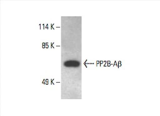 PP2B-Aβ Antibody (A-11) | SCBT - Santa Cruz Biotechnology