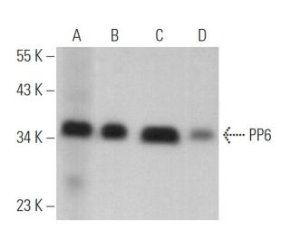 Anti-PP6 Antibody (E-2) | SCBT - Santa Cruz Biotechnology