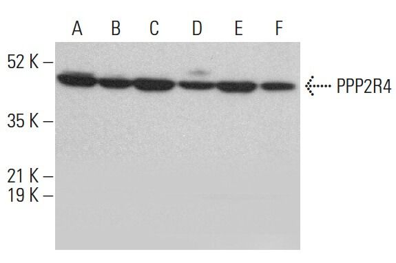 PPP2R4抗体 (5G3) | SCBT - Santa Cruz Biotechnology