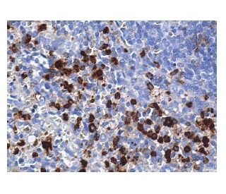 PR3 Antibody (D-1) - Immunohistochemistry - Image 157207