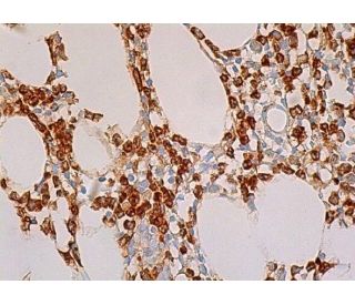 Anti-PR3 Antibody (D-1) | SCBT - Santa Cruz Biotechnology