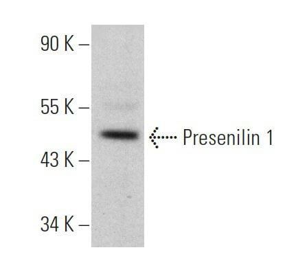 Presenilin 1 Antibody (D-10) | SCBT - Santa Cruz Biotechnology