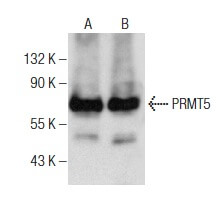 Anti-PRMT5 Antibody (A-11) | SCBT - Santa Cruz Biotechnology