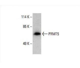 PRMT5 Antibody (A-11) - Western Blotting - Image 392577