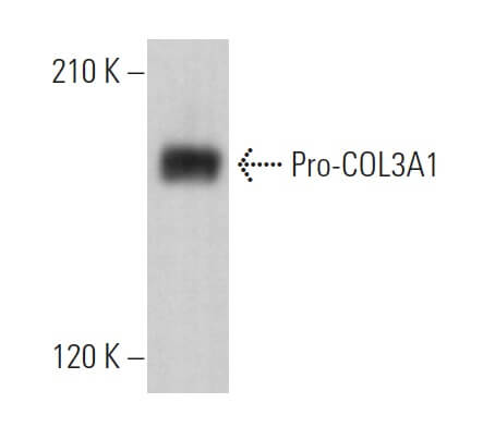 Anti-Pro-COL3A1 Antibody (A-1) | SCBT - Santa Cruz Biotechnology