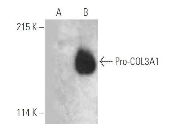 Pro-COL3A1 Antibody (A-1) | SCBT - Santa Cruz Biotechnology
