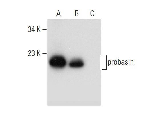 probasin Antibody (F-6) | SCBT - Santa Cruz Biotechnology