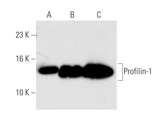 Anti-Profilin-1 Antibody (B-10) | SCBT - Santa Cruz Biotechnology