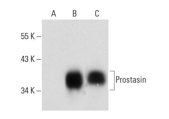 Prostasin Antibody (2) | SCBT - Santa Cruz Biotechnology