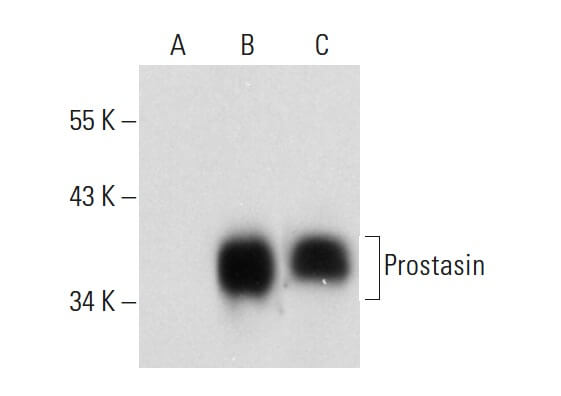 Prostasin Antibody (2) | SCBT - Santa Cruz Biotechnology