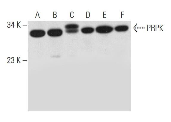 PRPK Antibody (C-1) | SCBT - Santa Cruz Biotechnology