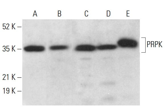 PRPK Antibody (C-1) | SCBT - Santa Cruz Biotechnology