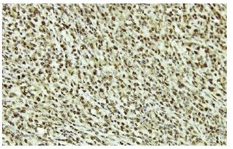 PRPK Antibody (F-9) | SCBT - Santa Cruz Biotechnology