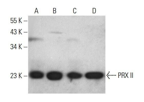 PRX II Antibody (A-2) | SCBT - Santa Cruz Biotechnology