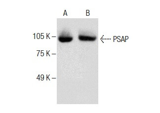 PSAP Antibody (E-5) | SCBT - Santa Cruz Biotechnology
