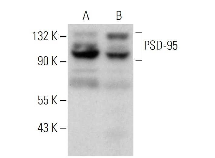 PSD-95抗体 (2Q128) | SCBT - Santa Cruz Biotechnology