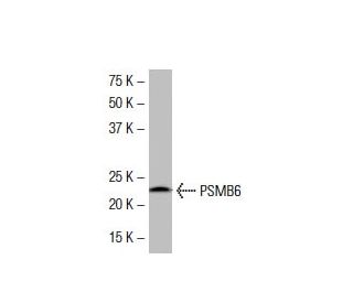 PSMB6 Antibody (JQ-3) | SCBT - Santa Cruz Biotechnology
